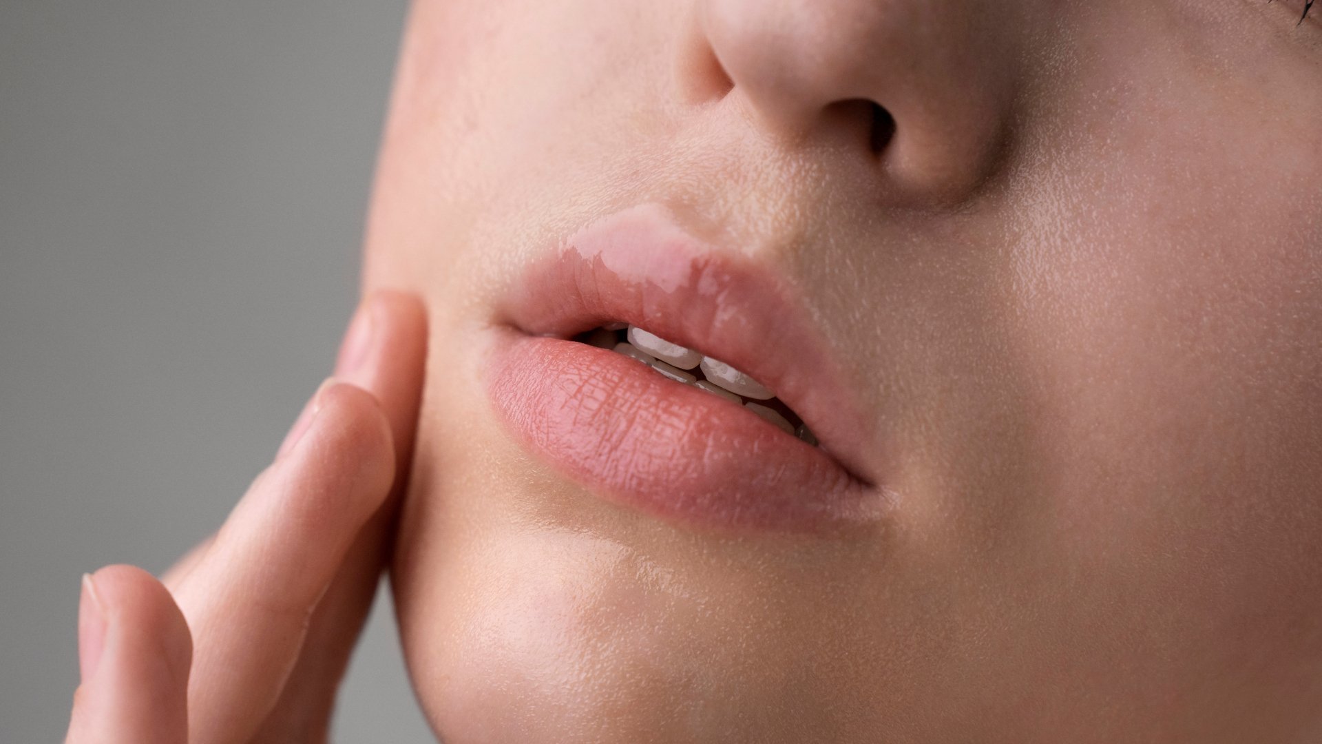 Jaka jest najlepsza maść na zajady – który preparat wybrać? Co pomoże ...